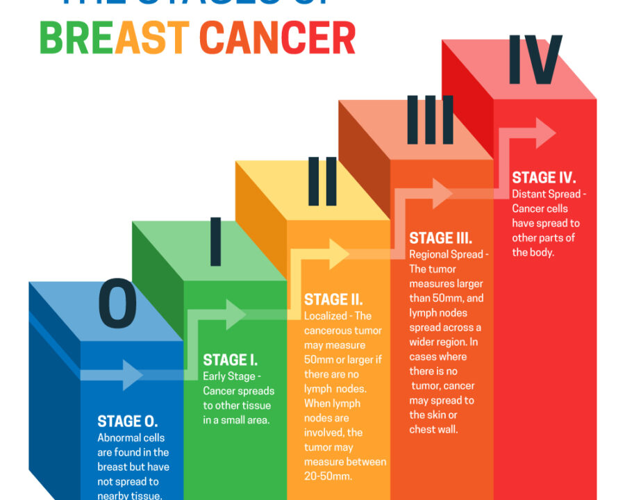 Understanding the 5 Stages of Breast Cancer and Prognosis – West ...